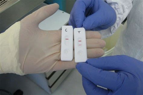 Ebola Un Test De Détection Plus Rapide Que Celui De Biomérieux