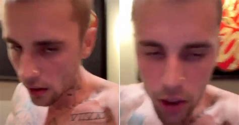 Justin Bieber Wants Attention And Appears Stressed In Recent Video
