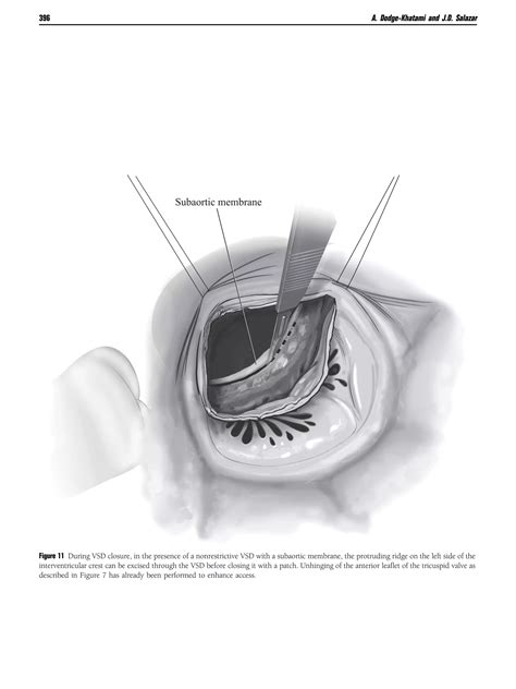 Right Axillary Operative Techniques 2016 Pdf