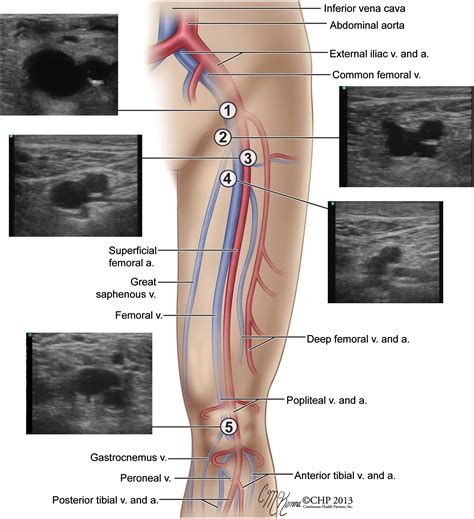 Lower Limb Venous Anatomy