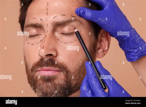 Doctor Drawing Marks On Mans Face For Cosmetic Surgery Operation
