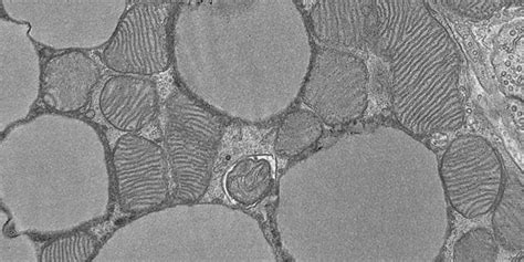 Brown Fat How Cells Generate Heat By Burning Calories