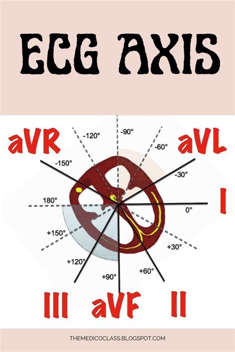 Ecg Waves Artofit