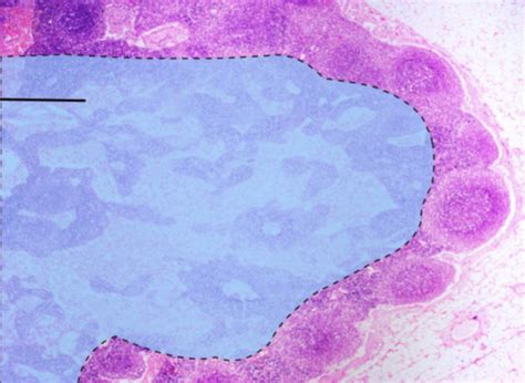 Ch 1 Basic Immunology Flashcards Quizlet