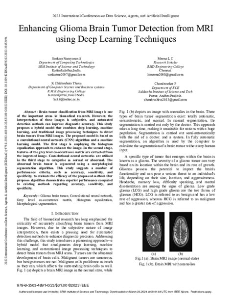 Pdf Enhancing Glioma Brain Tumor Detection From Mri Using Deep