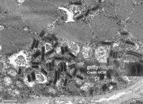 Mitochondria Microscope Photos And Premium High Res Pictures Getty Images