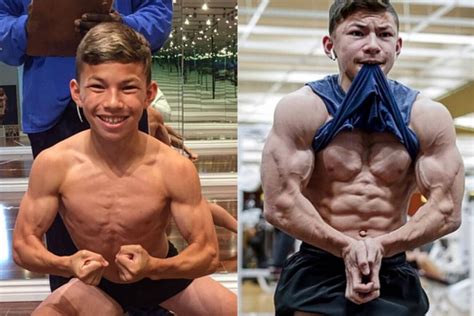 El antes y después de tristyn lee el niño MARCA