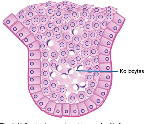 Koilocytes