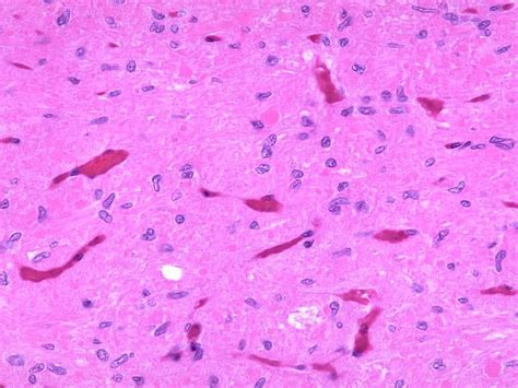Posterior Pituitary