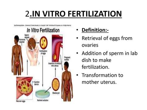 Recent Advancement In Infertility Final Ppt PPTX
