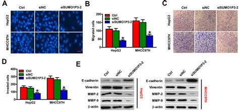 Lncrna Sumo1p3 Acts As A Prognostic Biomarker And Promotes