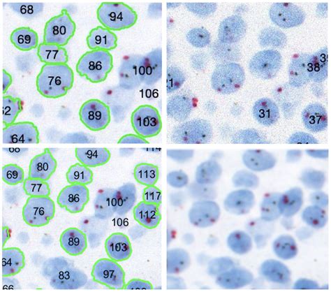 The Nuclei Detection Method Succeeded For The Original Top Left And