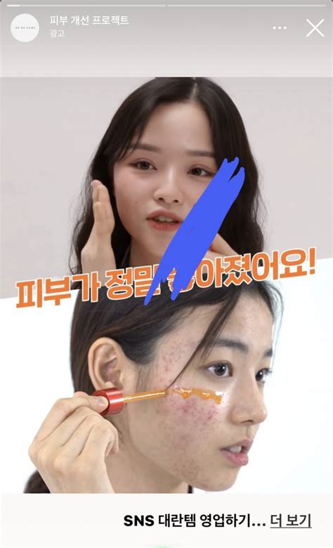 피부 안좋아도 예쁠사람은 인스티즈instiz 일상 카테고리