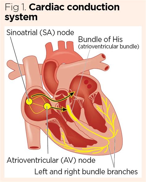 Pacemaker Therapy Clinical Indications Placement And Complications