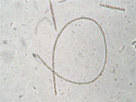 Korseby Online Cyanobacteria
