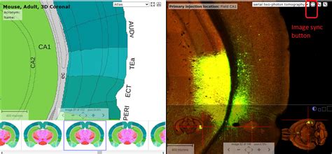 matching experiment section images with brain segmentation technical