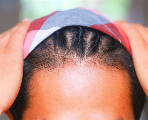 From Skin To Hair Alum Is The Solution For All Your Problems HerZindagi