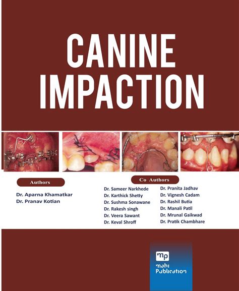 Canine Impaction Draparna Khamatkar Drpranav Kotian
