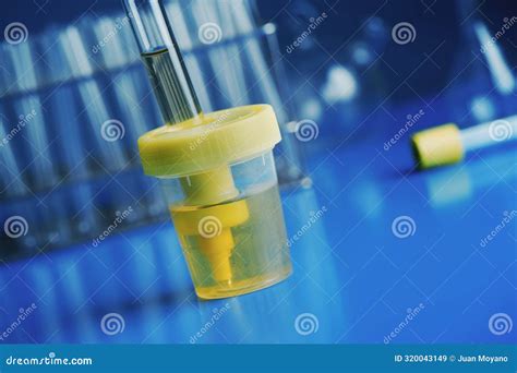 Container With A Sample Of Urine In The Laboratory Stock Image Image Of Urinalysis Tube