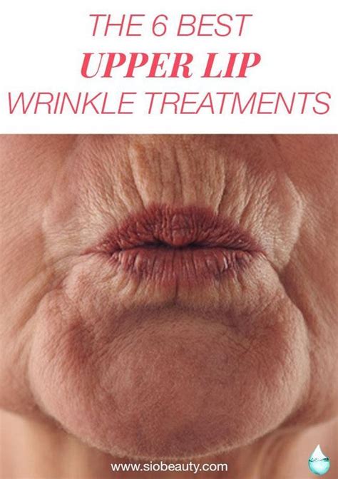 Tips To Help Get Rid Of Smokers Lines Lip Lines Or Lip Wrinkles
