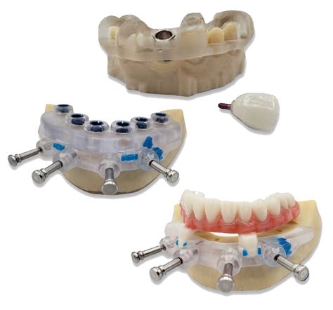 Implant Concierge™ Zimvie Americas