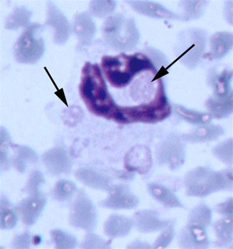 Figure Ehrlichia Ewingii Infection In White Tailed Deer Odocoileus