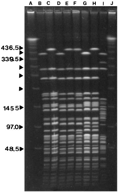 Pfge Banding Patterns Of Not I Digested Total Cellular Dnas From
