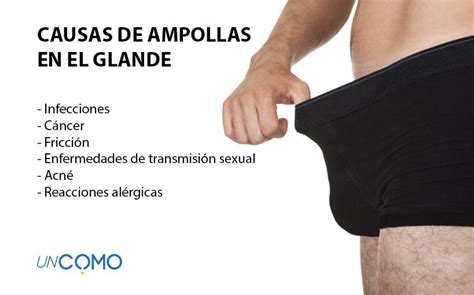 Causas Y Tratamiento De Las Ampollas En El Glande