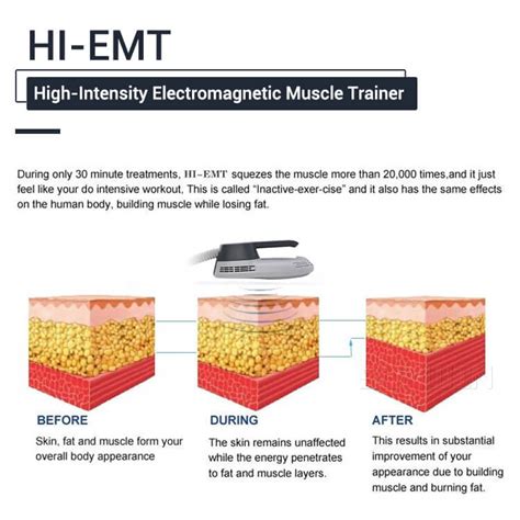 Emslim Nova Body Contouring Machine With Rf Goemslim