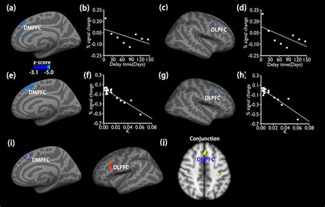 The Brain Regions Modulated By The Delay Length Of Future Rewards The