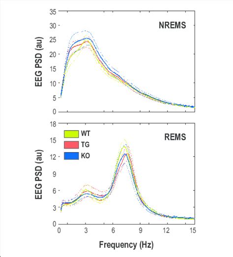 figure s1—power spectral density psd of the electroencephalographic