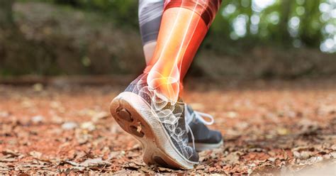 The Ultimate Guide To Compression Socks For Large Calves Medium