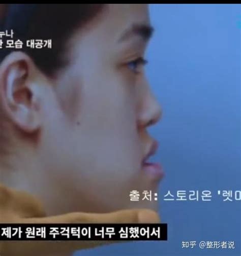 鞋拔子脸做双鄂8年后，是种什么样的体验 知乎