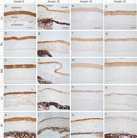 Keratin 5 19 And 12 Immunohistochemistry Of Corneal Epithelia From