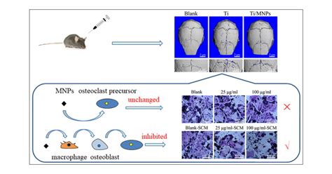 Mgo Nanoparticles Protect Against Titanium Particle Induced Osteolysis In A Mouse Model Because