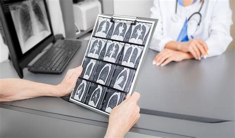 When To Worry About Pulmonary Nodules