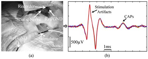A Bidirectional Neuromodulation Technology For Nerve Recording And Stimulation