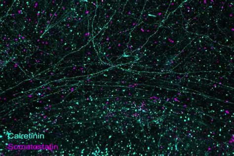 Technologies Enable 3d Imaging Of Whole Human Brain Hemispheres At