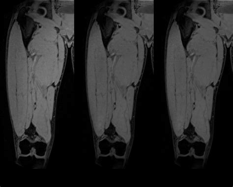 1 image of a subject in our dataset before and after each step of