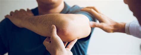 What Is Tennis Elbow And How Does It Start