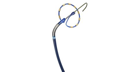 Medtronic Pulseselect Pfa System Demonstrates Impressive Results In