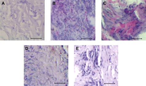Histological Characteristics Of Normal And Osteosarcoma Tissues Notes