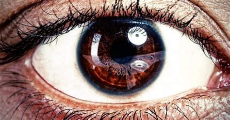 Scientists Are Using Algae Dna To Restore Sight To The Blind Science