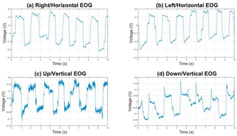 Eog Signal Classification With Wavelet And Supervised Learning