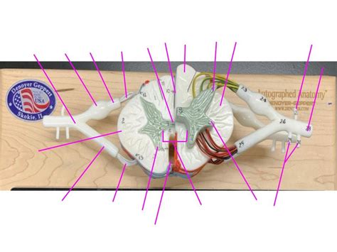 Vertebrae Cross Section Model Diagram Quizlet