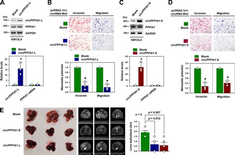 Overexpression Of Circppfia1s Attenuates Metastatic Potential Of Km12l4