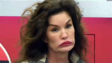 Janice Dickinsons Plastic Surgery Facelifts Boob Job Tummy Tuck