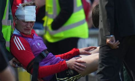 Jack Mackenzie Needs Stitches After Being Struck By Aberdeen Fans