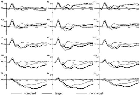 Grand Averaged Erp Recorded In Active Condition For Each Stimulus Type