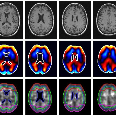 Regional Variation In The Shear Modulus Of In Vivo Brain All Download Scientific Diagram